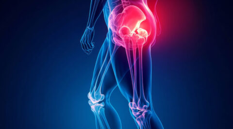 Understanding Hip Flexor Pain: Causes, Treatment, and Prevention ...